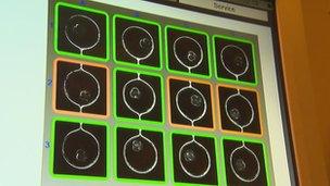 First baby conceived with time-lapse imaging IVF born in Glasgow - BBC News