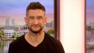 Swindon scaffolder's hand transplants 'changed his life' - BBC News