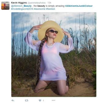 Challenging Africa's albino stereotypes - BBC News
