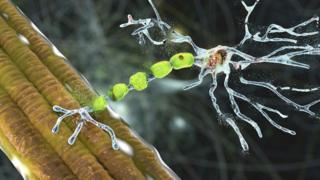 'Truly remarkable' drug helps motor neurone disease - BBC News