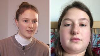 Mumps cases hit decade high in England - BBC News
