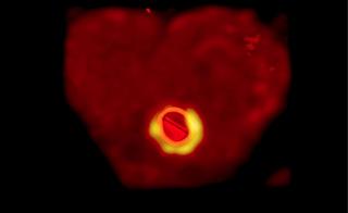 British Heart Foundation: A colourful image of blood vessel cells wins ...