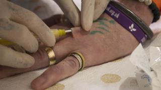 The transhumanists who are 'upgrading' their bodies - BBC News