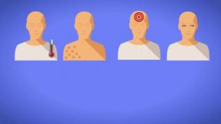 Zika-linked condition: WHO declares global emergency - BBC News