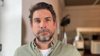 Actor had brain tumour the size of a lime - BBC News