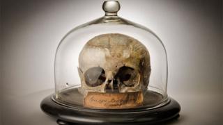 Serial killer William Burke's skeleton goes on display - BBC News