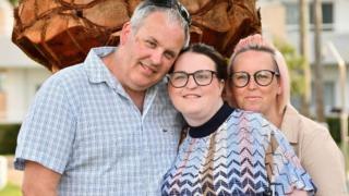 Kidderminster woman missing part of skull in operation plea - BBC News