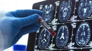 Health | Latest News & Updates | BBC News