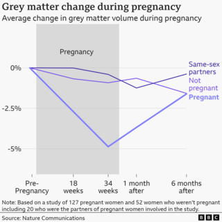 Pregnant women's brains shed grey matter to prime them for motherhood ...