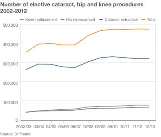 Key NHS operations 'being rationed' - BBC News