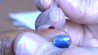 HIV home test kit goes on sale in UK - BBC News