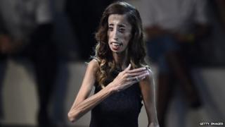 Lizzie Velasquez: 'Online bullies called me the world's ugliest woman ...