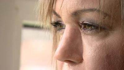 Emily Eccles was left holding part of her jaw in her hands after a ...