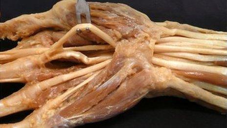 The living dead: new embalming method aids surgical training - BBC News