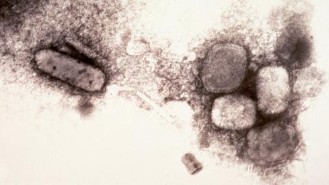 How smallpox claimed its final victim - BBC News