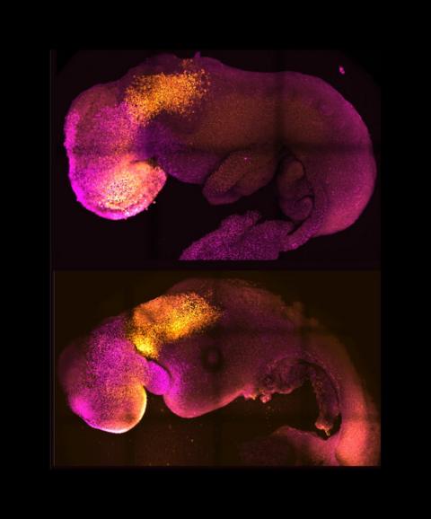 Synthetic human embryo raises ethical issues - BBC News
