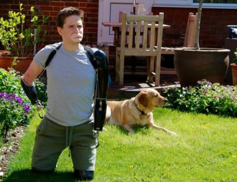 The quadruple amputee who needs the correct prosthetic - BBC News