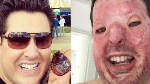 Truro acid attack victim Andreas Christopheros calls for law changes ...