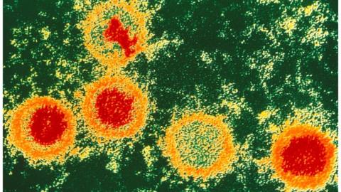 Cancer virus discovery helped by delayed flight - BBC News