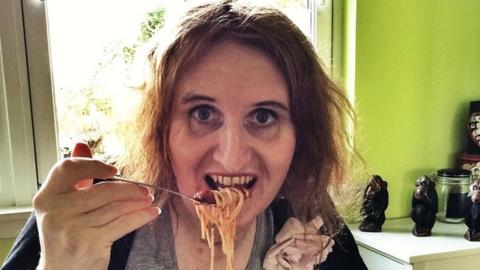 Stag gore victim Kate Stone able to eat after four months - BBC News