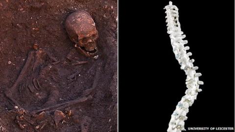 Richard III: Team rebuilds 'most famous spine' - BBC News