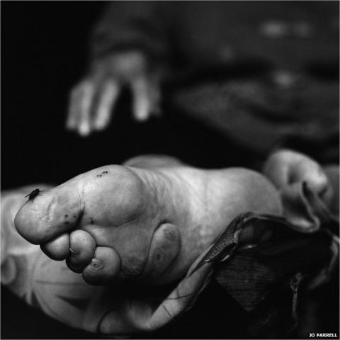 Chinese foot binding - BBC News