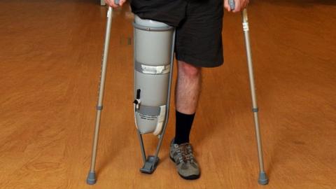Lesser-known things about prosthetic legs - BBC News