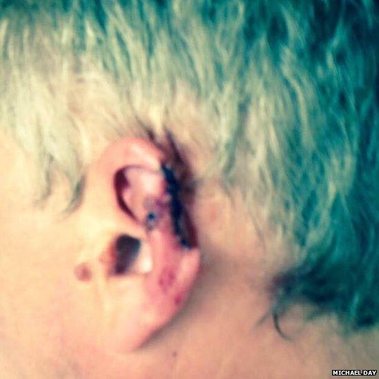 Man had ear bitten off at Splendour Festival - BBC News