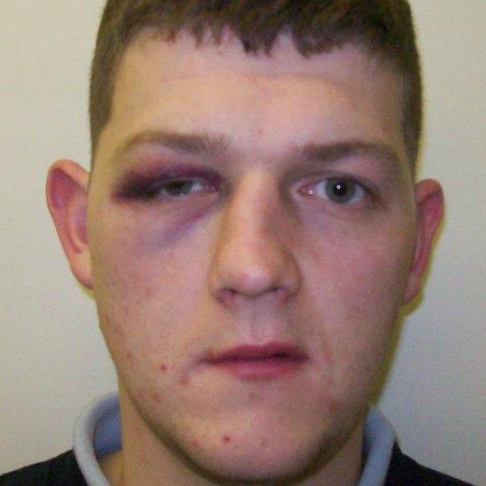 Louth loft ladder suffocation killer Harry Scott jailed - BBC News