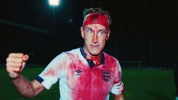 Sporting injuries: The athletes who carried on injured - BBC News