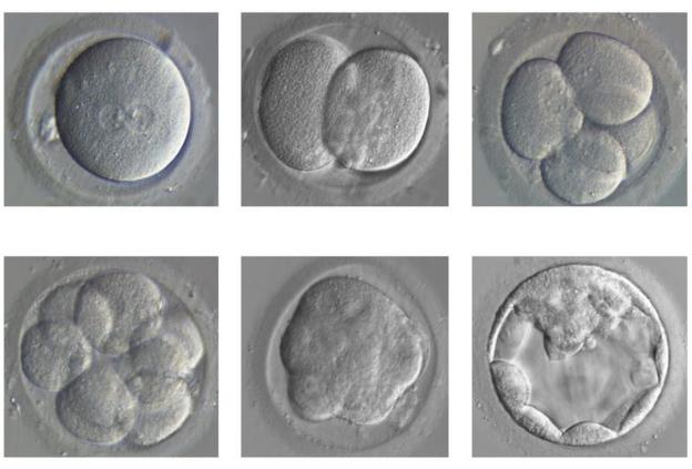 Scientists get 'gene editing' go-ahead - BBC News
