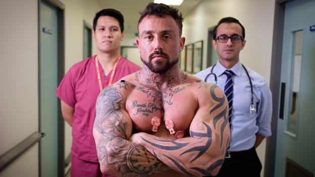 Bodybuilding: 'Steroids gave me heart failure at 30' - BBC News