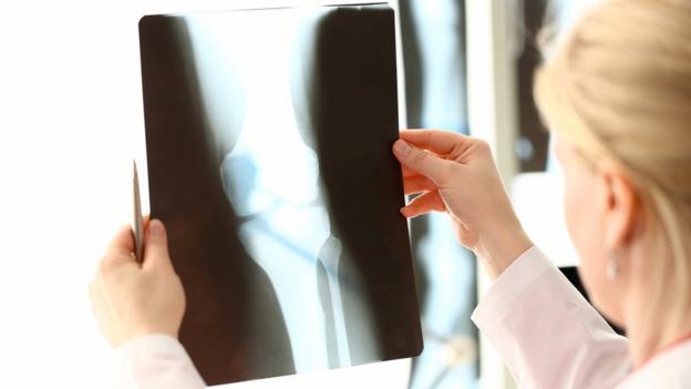 The risks behind the hype of stem-cell treatments - BBC News