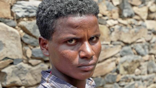 Ethiopia's Tigray truce: 'I lost my leg on the way home from school ...