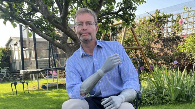 'Bionic lord' Craig MacKinlay takes seat in upper house - BBC News