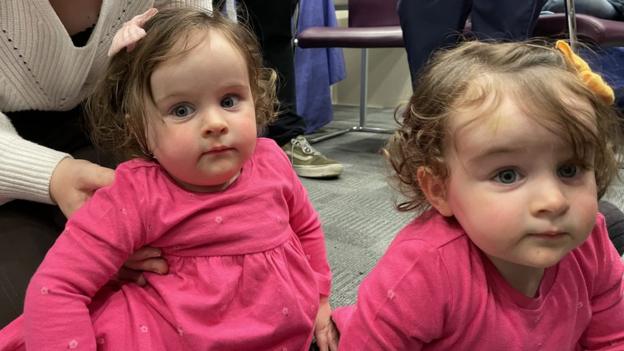 Conjoined twins: Defying the odds to survive - BBC News