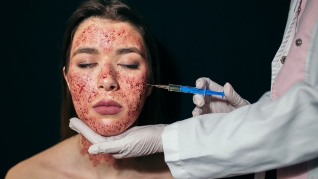 Seven tested for viruses after 'vampire facials' at Wolverhampton salon ...