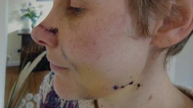 Stalking victim: I was living in hell - BBC News