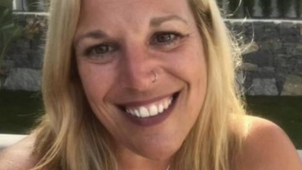 My limbs were amputated after sepsis, says MP Craig Mackinlay - BBC News