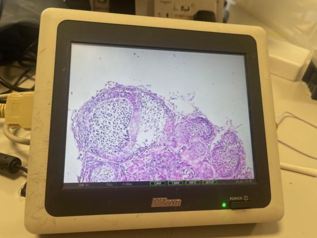 King's College scientists' lab-grown teeth breakthrough - BBC News