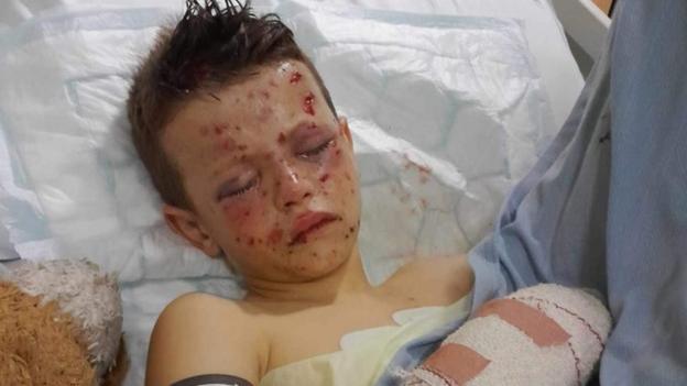 Hengoed boy loses fingers after picking up firework - BBC News
