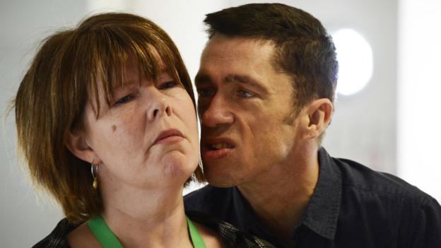 Arthur Hughes: First disabled Richard III is 'big gesture' from RSC ...