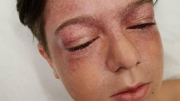 Boy hurt in 'stupid' YouTube roundabout stunt attempt - BBC News