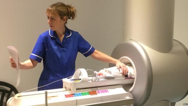 World's smallest MRI helps tiny babies - BBC News