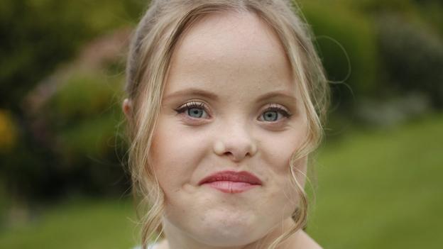 Down's syndrome: Model 'changing the face of fashion' - BBC News