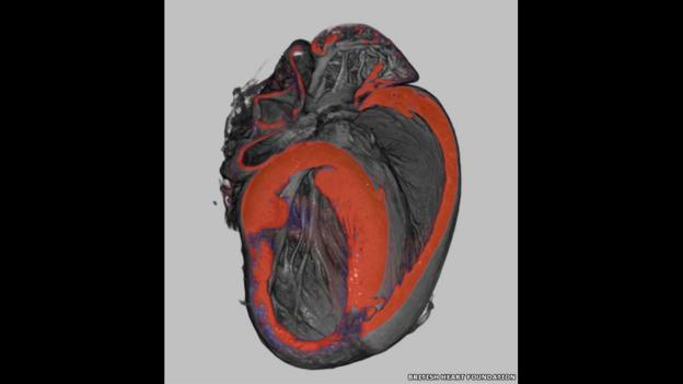 In pictures: Inside the heart - BBC News