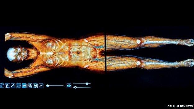 Anatomy students work on life-size virtual cadaver at University of ...