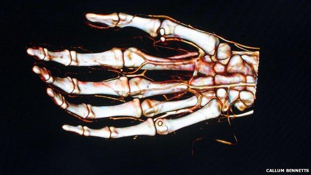 Anatomy students work on life-size virtual cadaver at University of ...