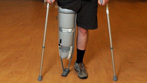 Lesser-known things about prosthetic legs - BBC News