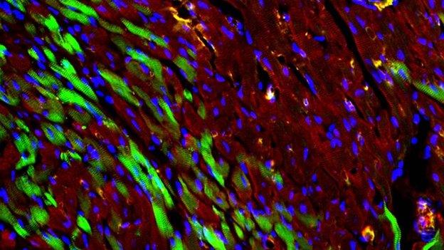 'Biological pacemaker' tested in lab - BBC News